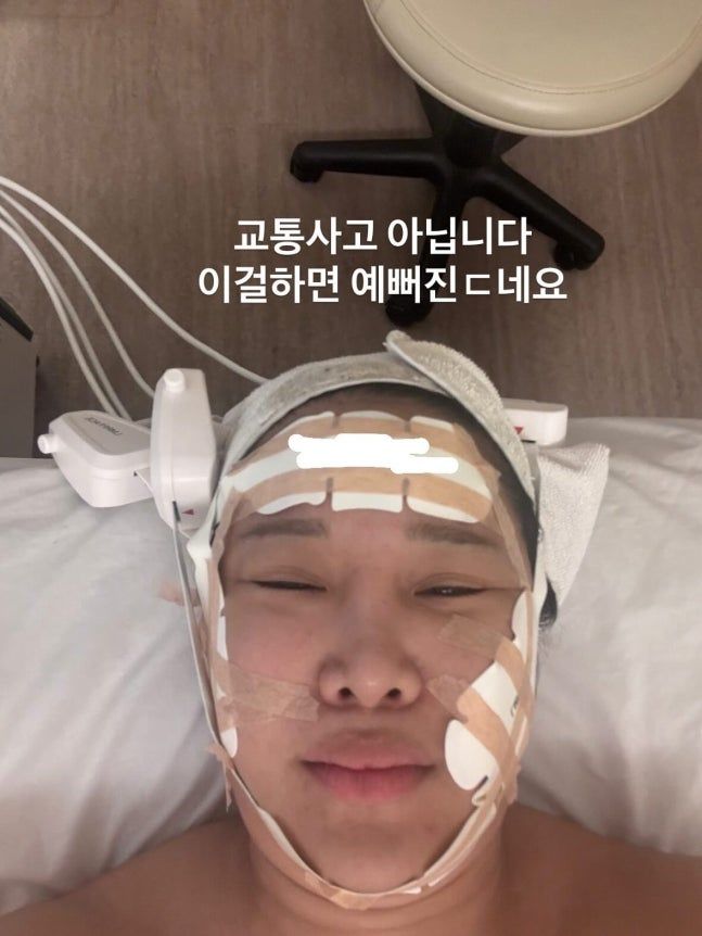 "교통사고 아닙니다"…랄랄, 얼굴 붕대 감고 무슨 일? :: 공감언론 뉴시스